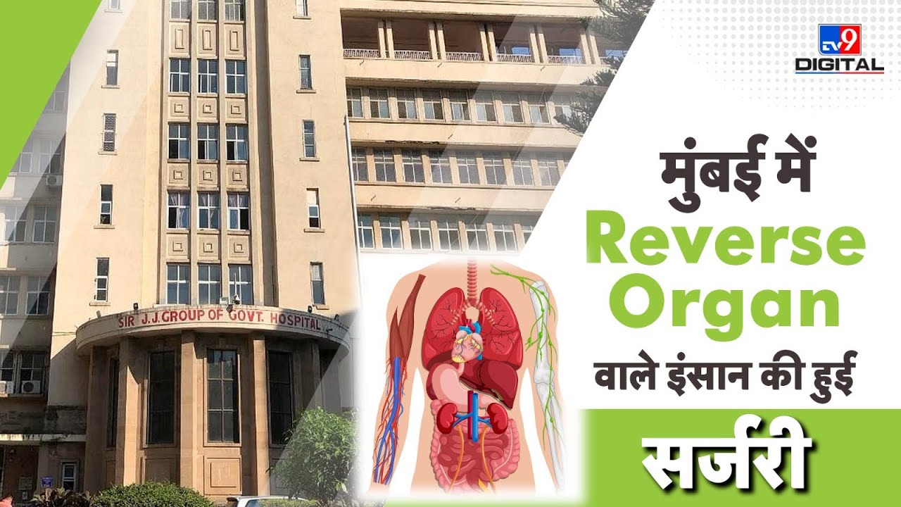 मुंबई के JJ Hospital में reverse organ वाले इंसान की हुई सफल सर्जरी | # ...