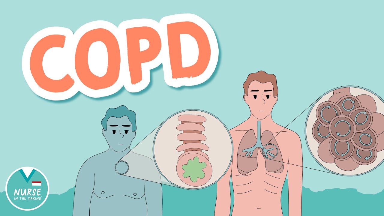 COPD - Chronic Obstructive Pulmonary Disease (Emphysema vs. Chronic ...