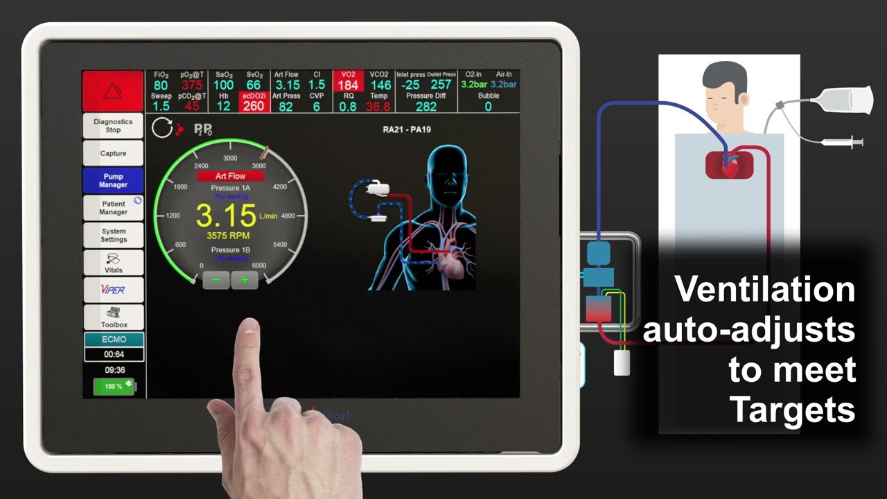Spectrum Medical's Auto Initiation 12" Workstation Elite - YouTube