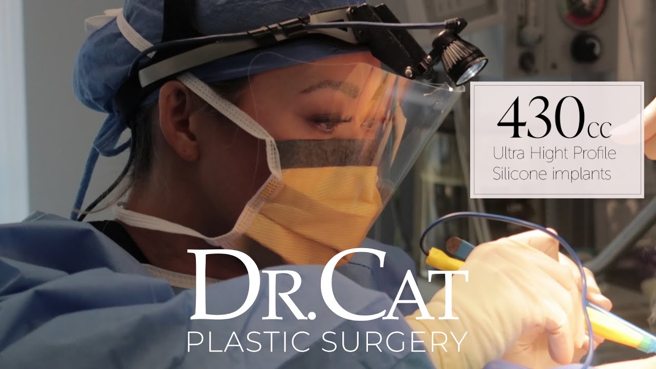 Breast Augmentation with 430cc Ultra High Profile Silicone Implants ...