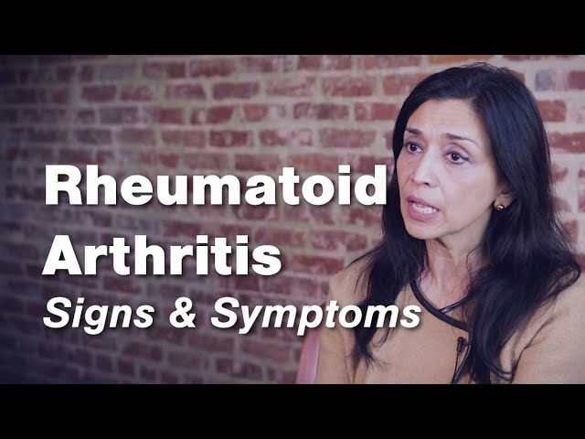 Felty Syndrome Symptoms Diagnosis Of Felty's Syndrome, Distinguished