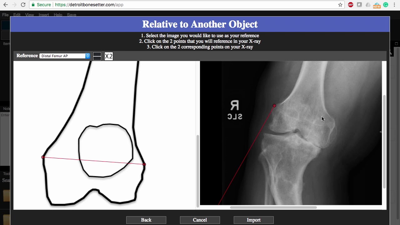 Bonesetter App How to size and enter x-rays - YouTube