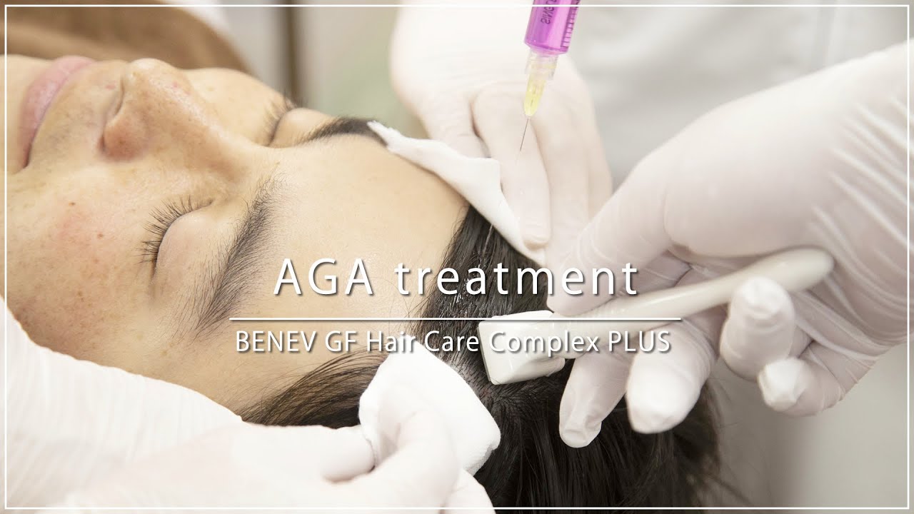 【病院でAGA治療】アメリカ BENEV（ベネブ）社製の成長因子「BENEV GF Hair Care Complex PLUS」を頭皮に ...