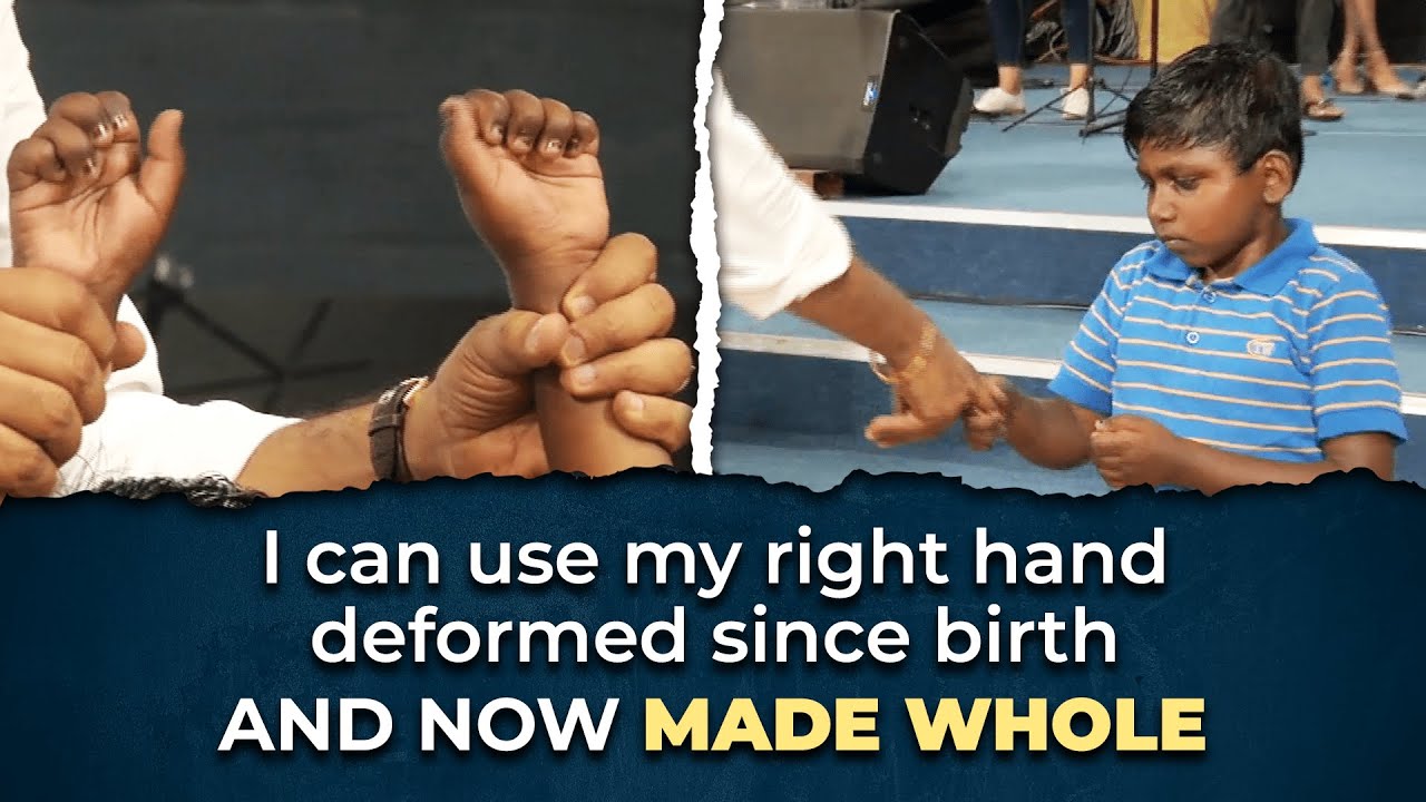 I CAN USE MY RIGHT HAND DEFORMED SINCE BIRTH AND NOW MADE WHOLE - YouTube