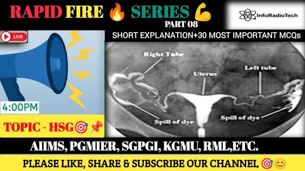HSG Radiography | Short Explanation+30 Most Important MCQs with Explanation | Rapid Fire Part 08 ...