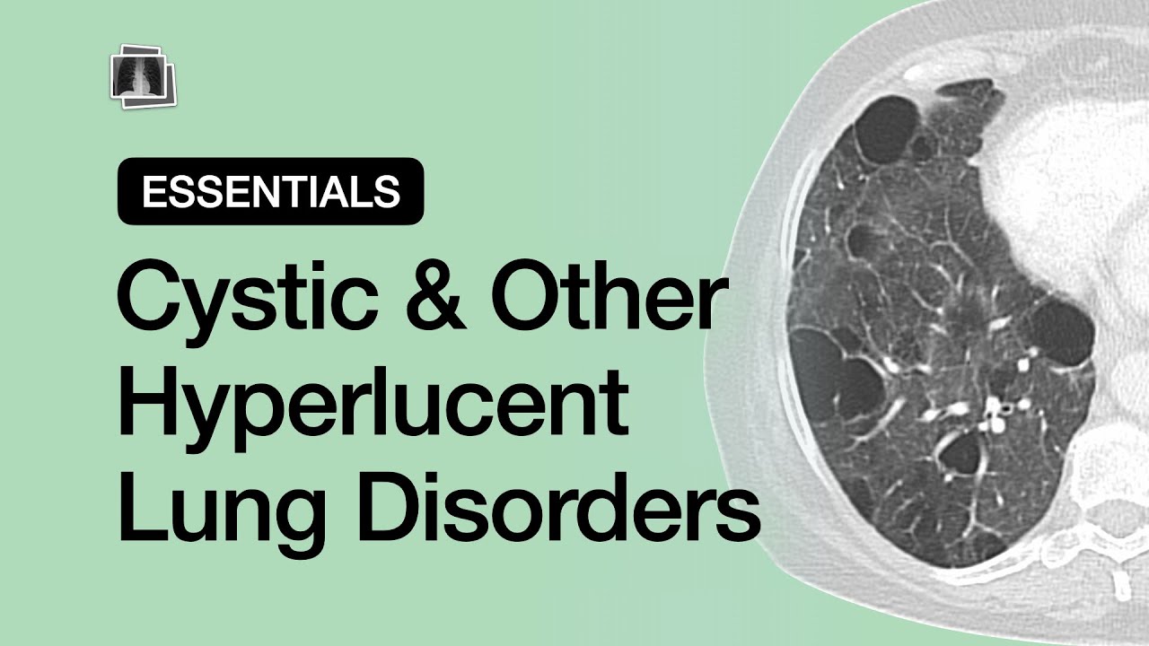 Cystic & Other Hyperlucent Lung Disorders | Chest Radiology Essentials ...
