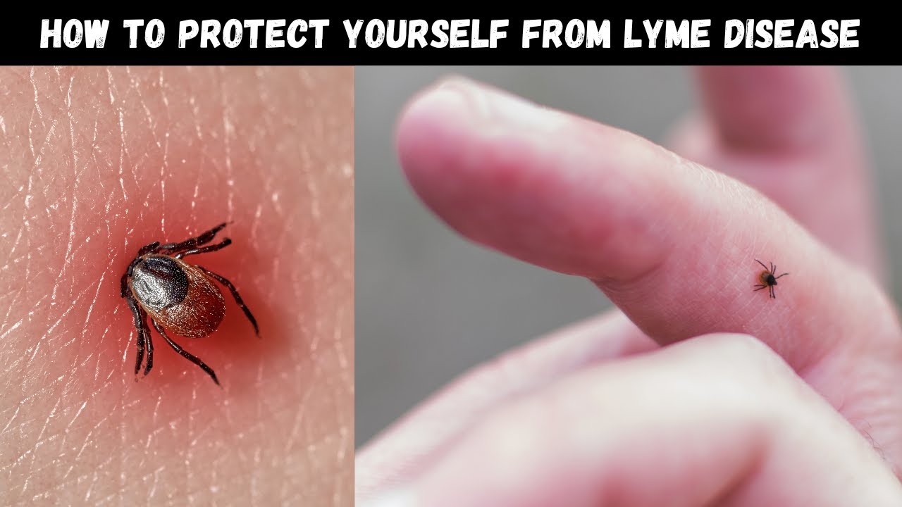 How to Protect Yourself from Lyme Disease Essential Tips! - YouTube