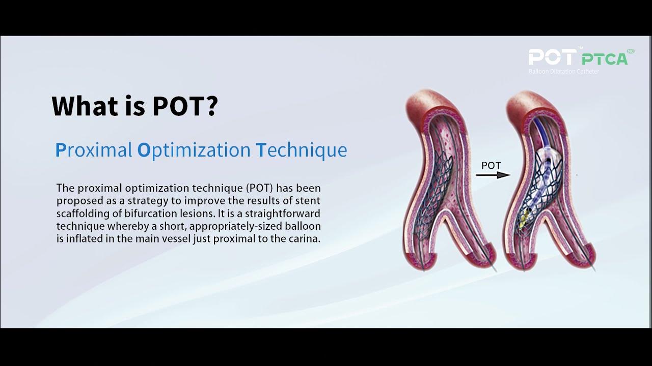 Brosmed POT PTCA Balloon Dilatation Catheter - YouTube