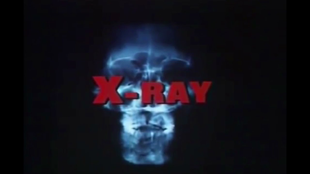 X-Ray (aka Hospital Massacre) 1982 - YouTube