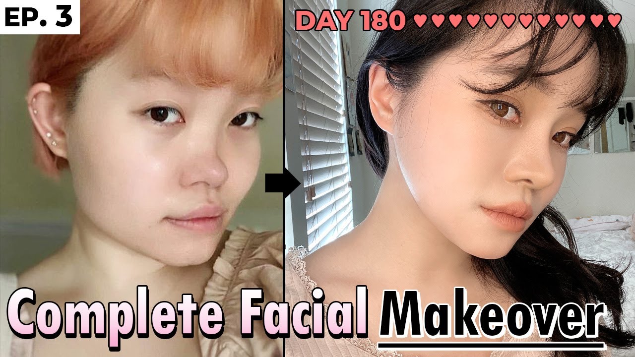 Korean Rhinoplasty Before And After DA Plastic Surgery Korea On X: