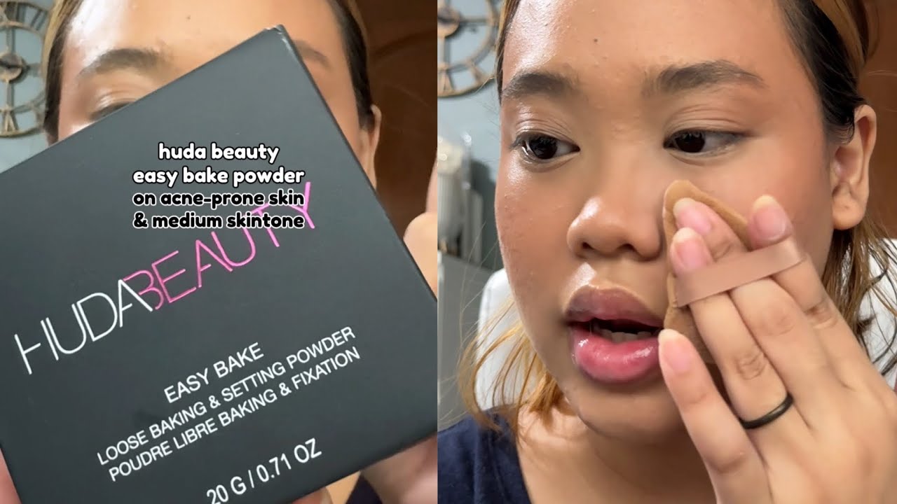 Huda Beauty Easy Bake Loose Powder (Pink Cherry Blossom) on acne-prone ...