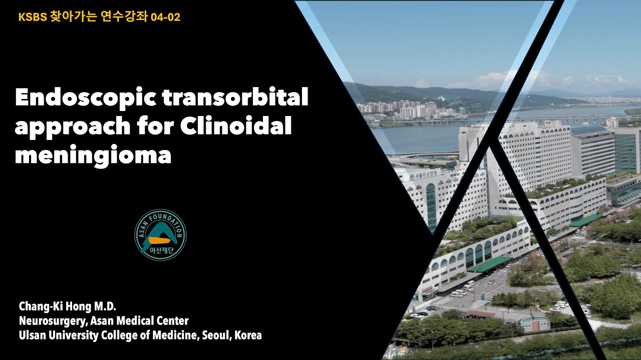 Endoscopic transorbital approach for clinoidal meningioma - YouTube