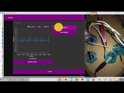 ECG Graph Monitoring with Hexabitz 🫀📉 - YouTube