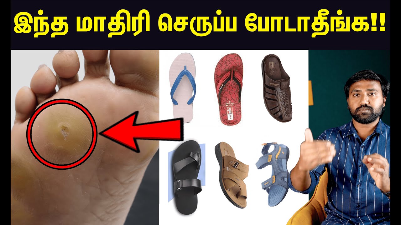 கால் ஆணி வராமல் இருக்க இத செய்யுங்க! | Foot Corn & Callus explained in ...
