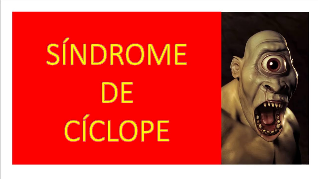 sindrome de ciclope - YouTube