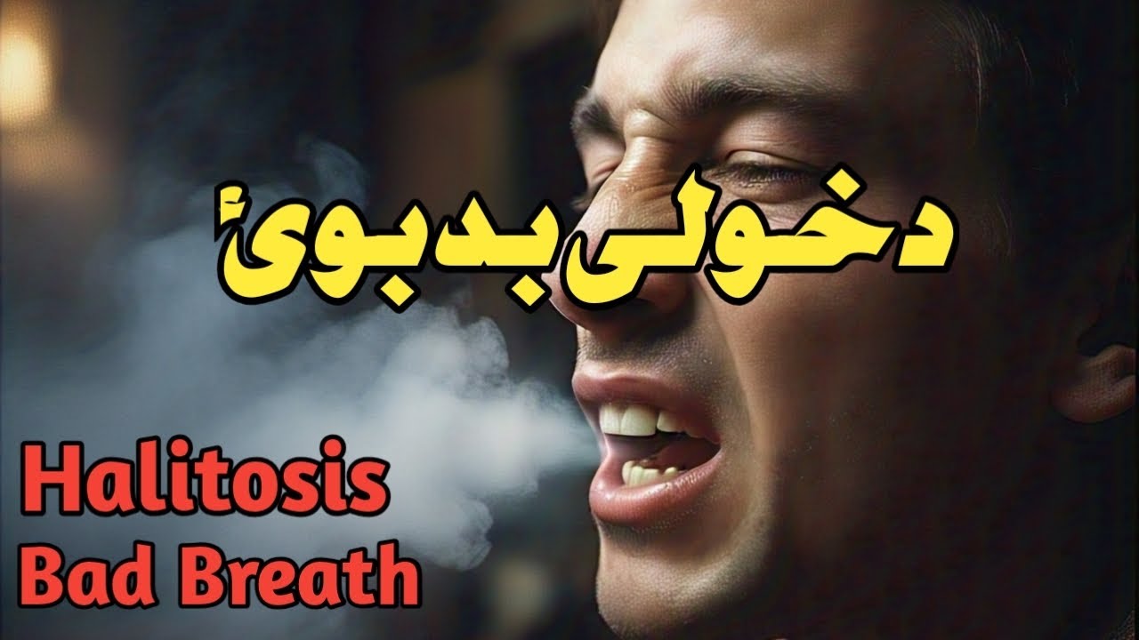 Halitosis Bad Breath in Pashto by Zia Ullah Gold Medalist Munh ki Bad ...