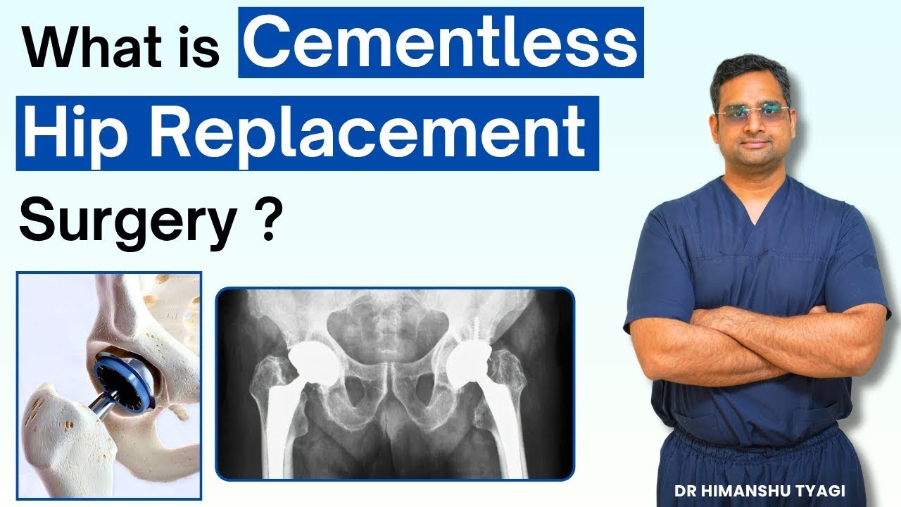 what is Cementless Hip Replacement Surgery? | Cementless Hip ...
