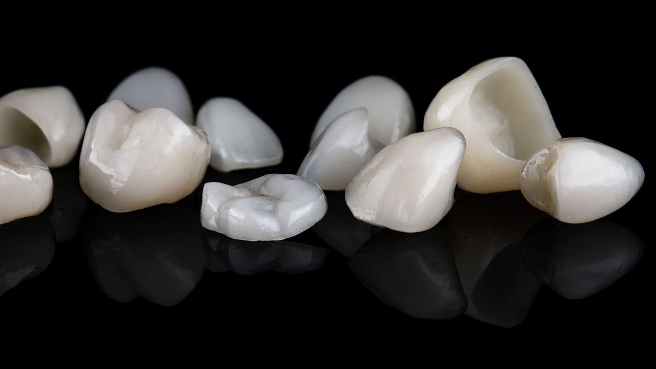 Wisdom Tooth Extraction: A Detailed Guide to the Procedure - What ...