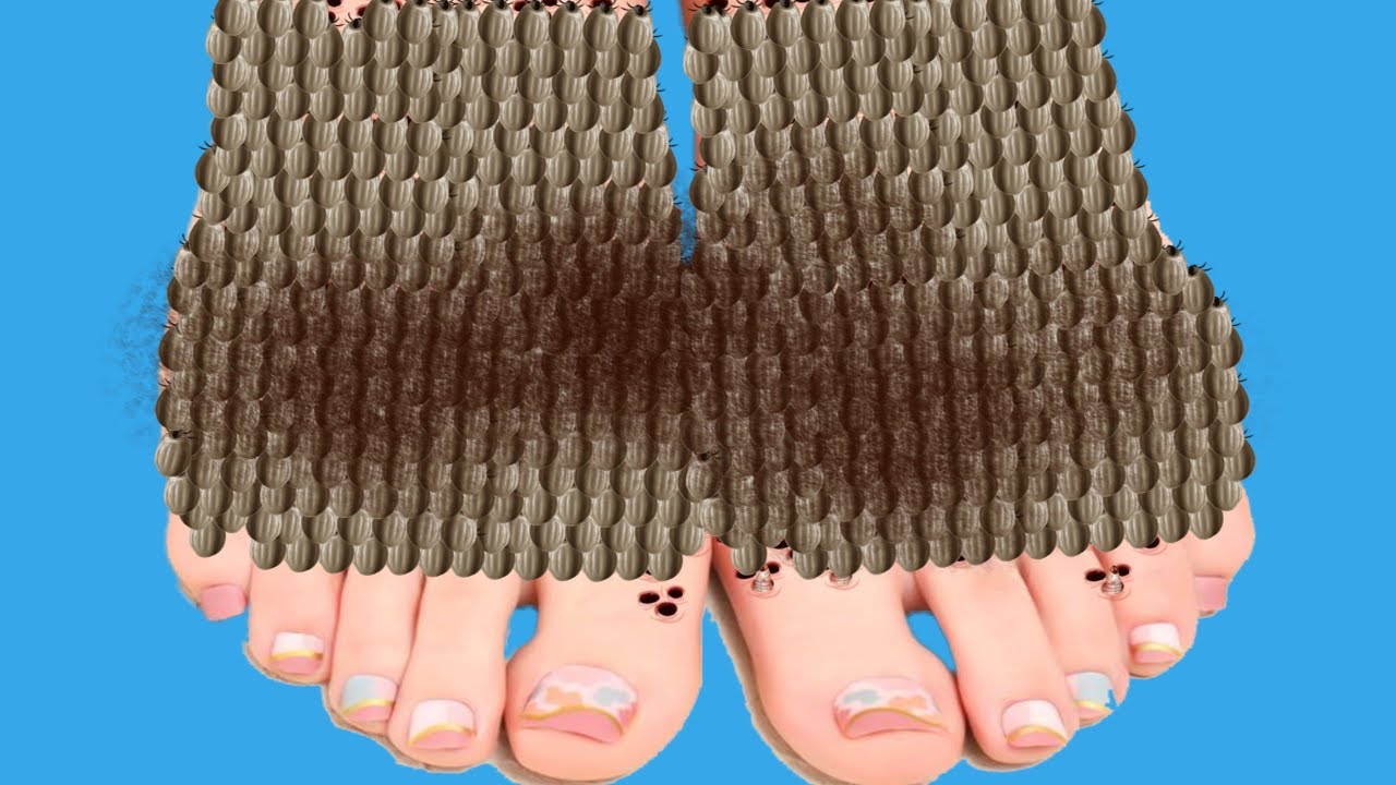 ASMR Treatment 2D Animation | Infected foot treatment | @HealAsmr914K ...