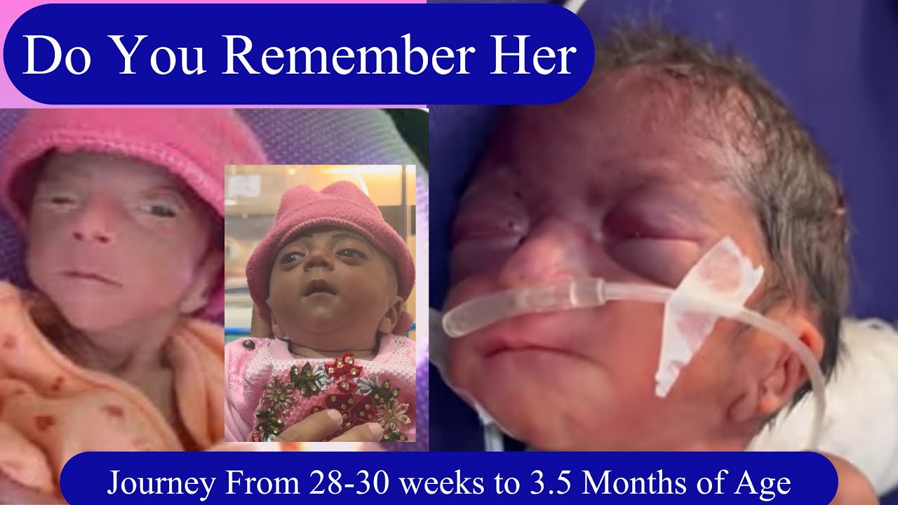 Do You Remember Her,Newborn Delivered at 28-30 Weeks Now 3.5Months Old ...