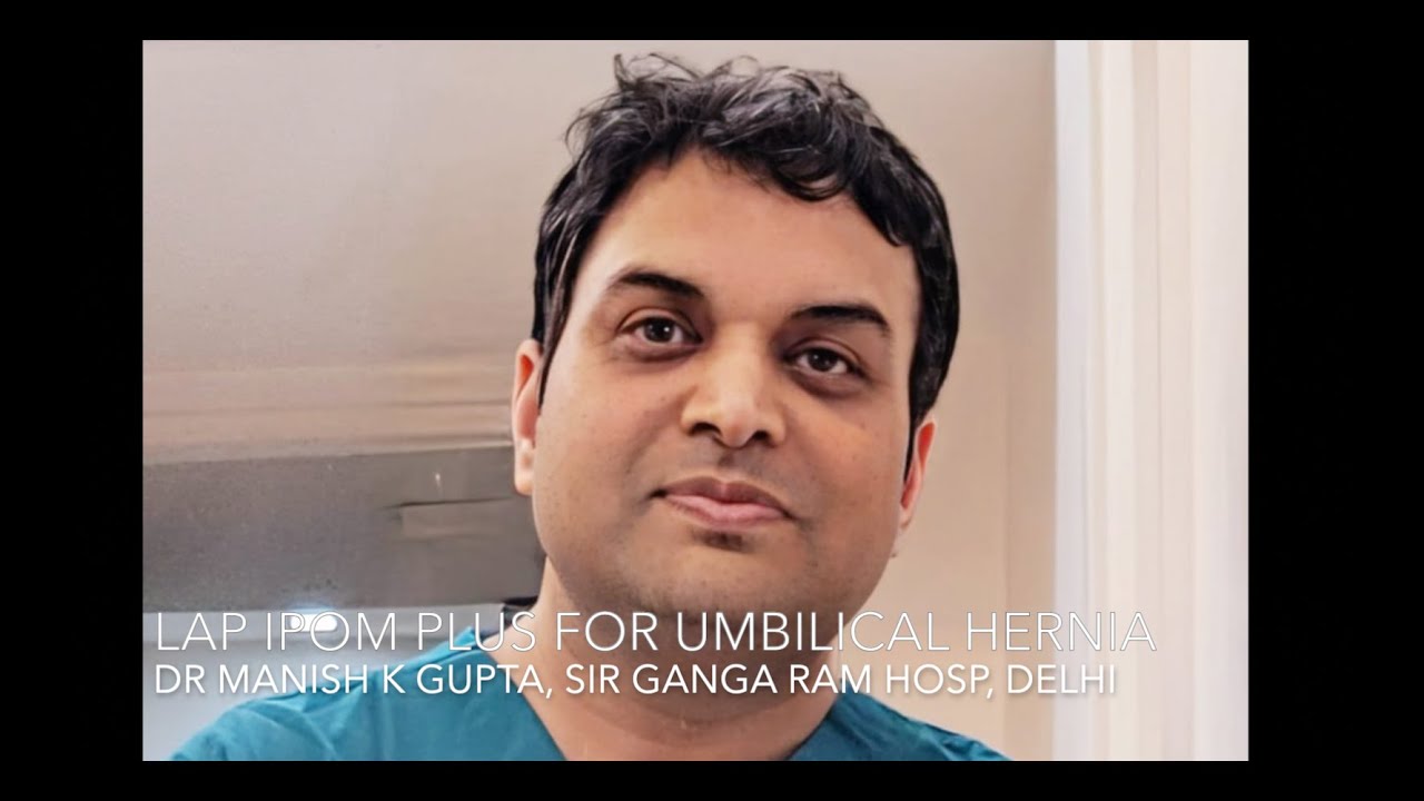 LAP IPOM PLUS FOR UMBILICAL HERNIA - DR. MANISH K GUPTA - YouTube