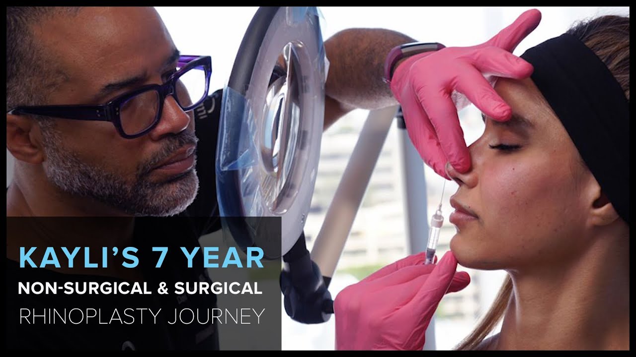 Nonsurgical and Surgical Rhinoplasty: Kayli's 7-Year Journey - YouTube