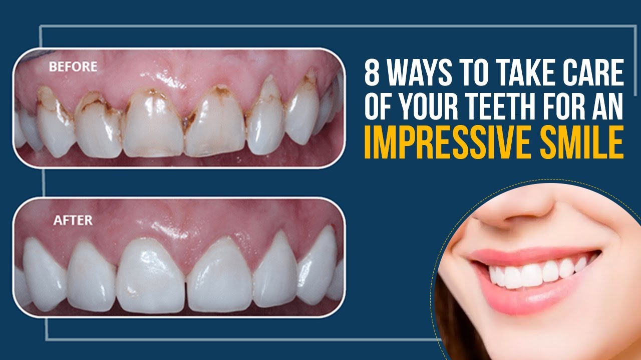How To Take Proper Care of Your Teeth? - YouTube