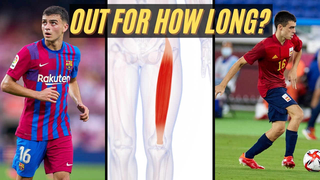 Expert Explains Pedri Injury (quadriceps strain) | When's He Back ...