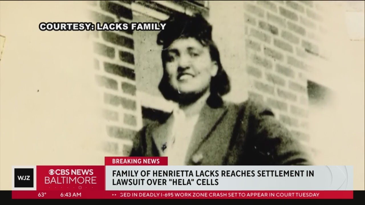 Henrietta Lacks' family reaches settlement over immortal 'HeLa cells ...