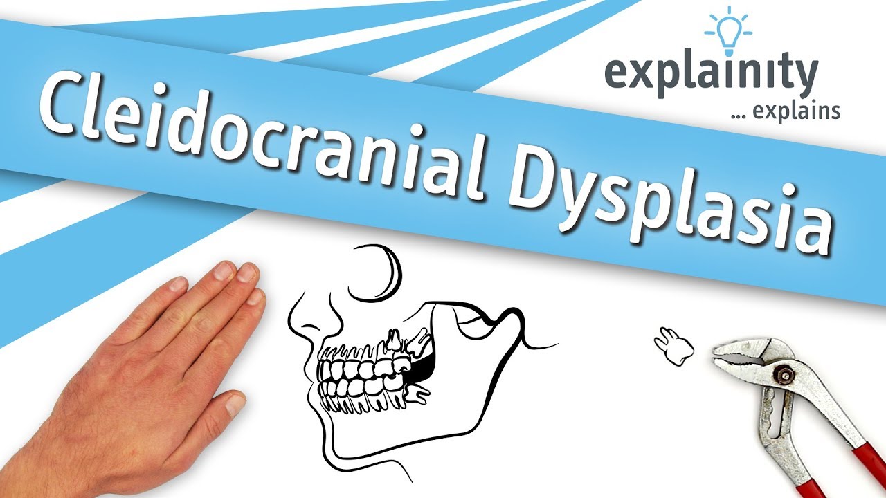 Cleidocranial Dysplasia explained (explainity® explainer video) - YouTube