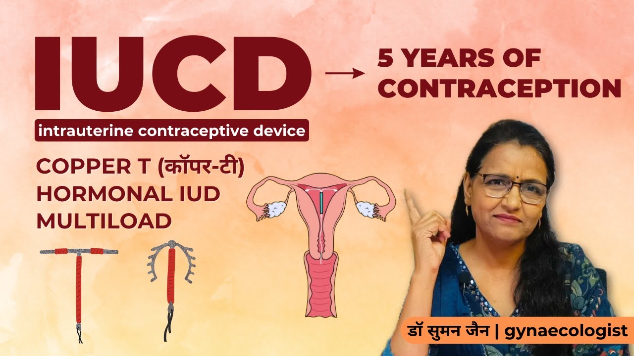 IUCD: Types, Benefits, Side Effects & Myths | IUD birth control in ...