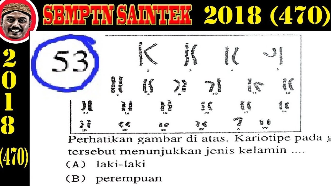 pembahasan soal SBMPTN SAINTEK 2018 BIOLOGI KODE 470 no 53, kelainan ...