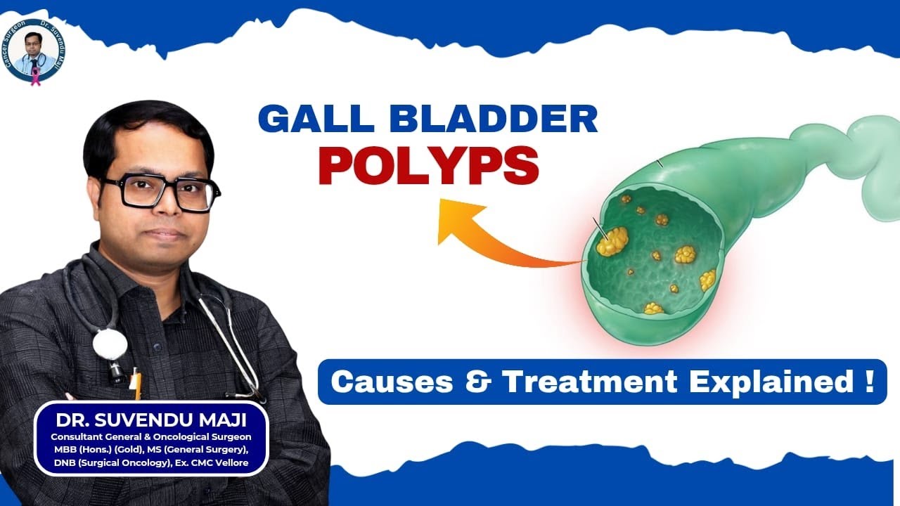 Gallbladder Polyps – Causes & Treatment Explained! Dr Suvendu Maji ...