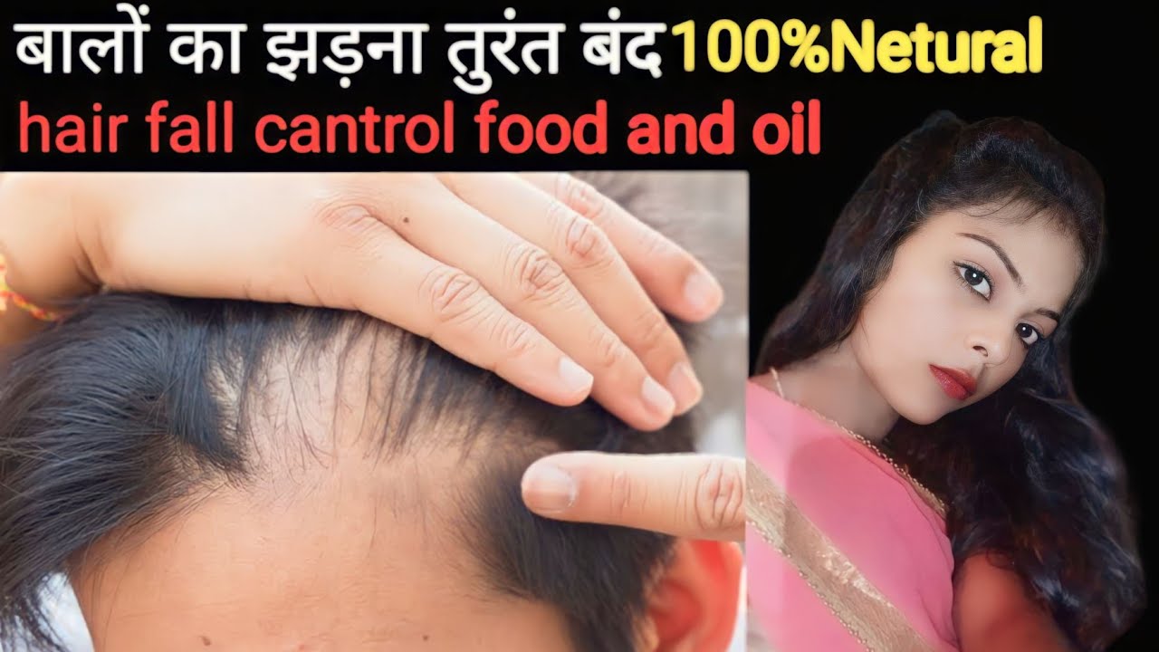 hair fall cantrol food and oil.hair fall solution at home . बालों का ...