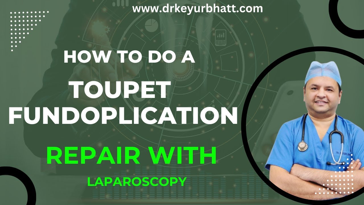 LIVE - Uncut Unetied | Lap Toupet fundoplication Surgery - Dr Keyur ...