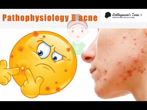 Skin type and acne : pathophysiology of acne and treatment - YouTube
