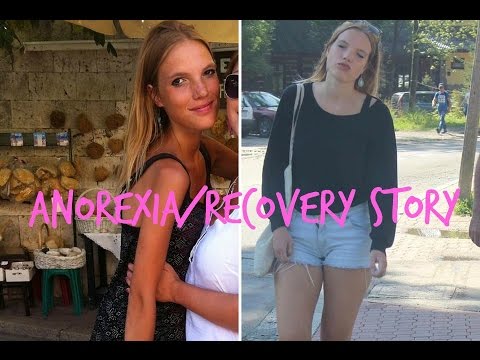 ANOREXIA/RECOVERY STORY - YouTube