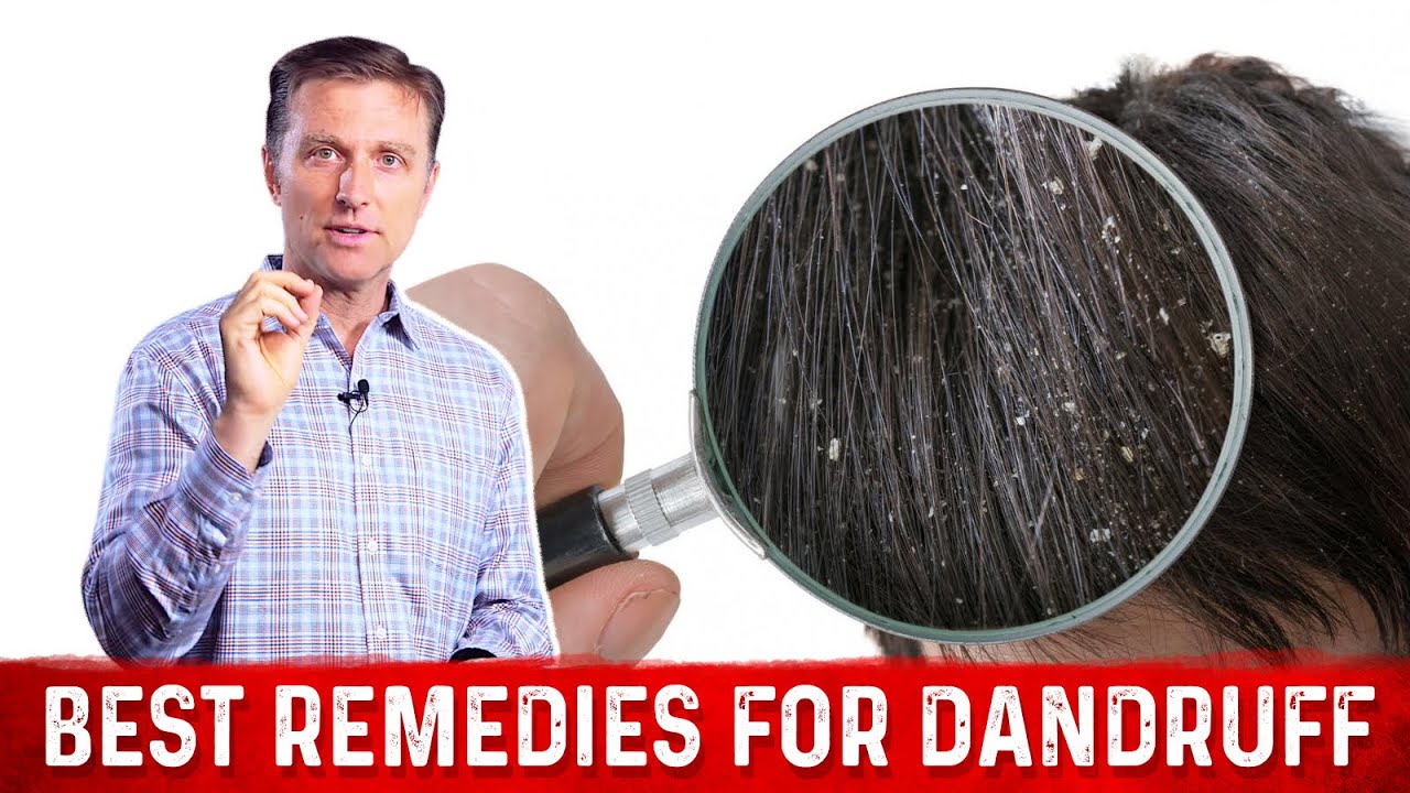 Best Natural & Home Remedies To Get Rid Of Dandruff – Dr. Berg - YouTube