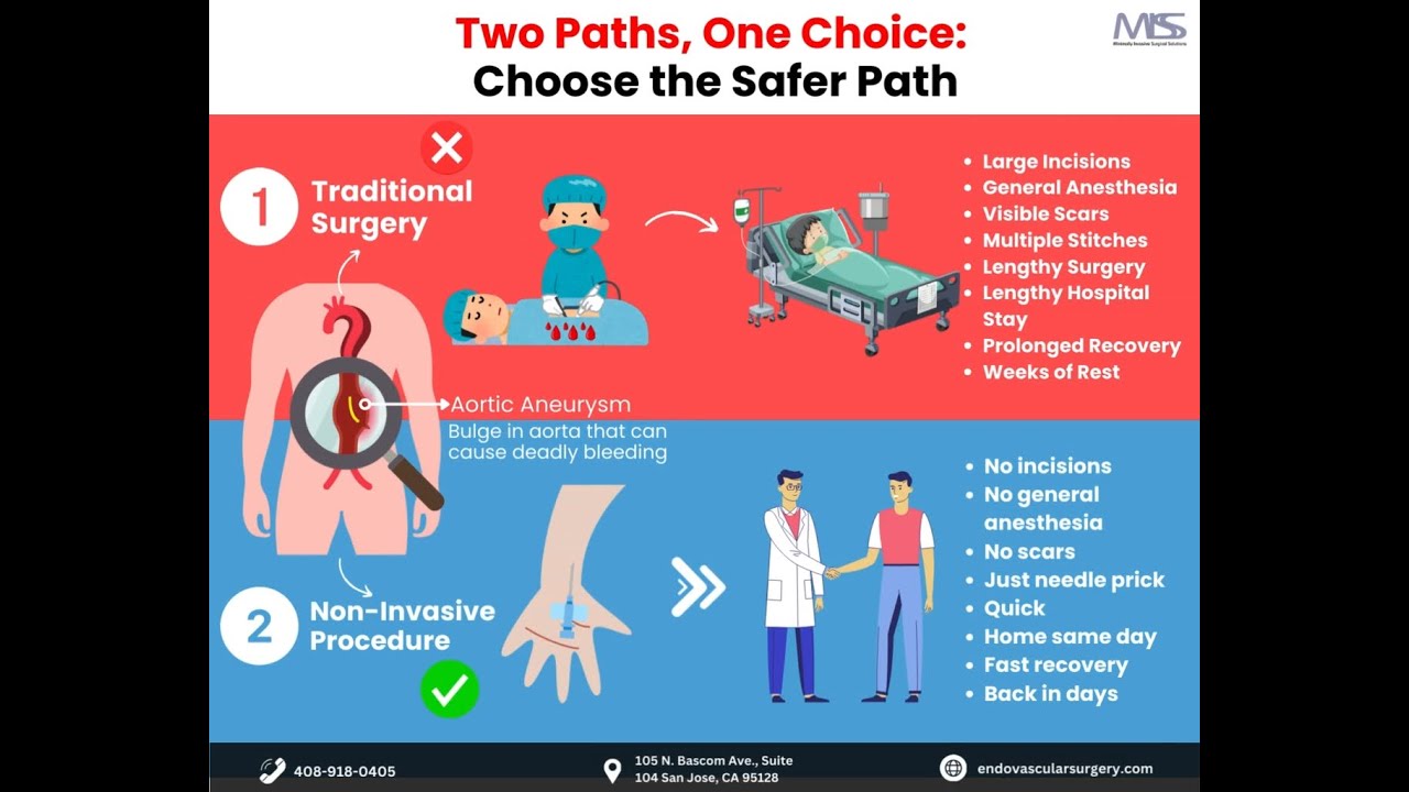 Aortic Aneurysm: Two Paths, One Choice - YouTube