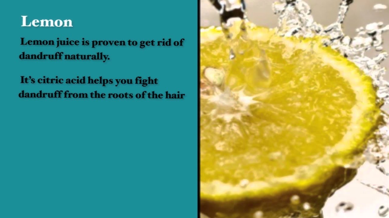 How to Remove Dandruff by Lemon || DIY - YouTube