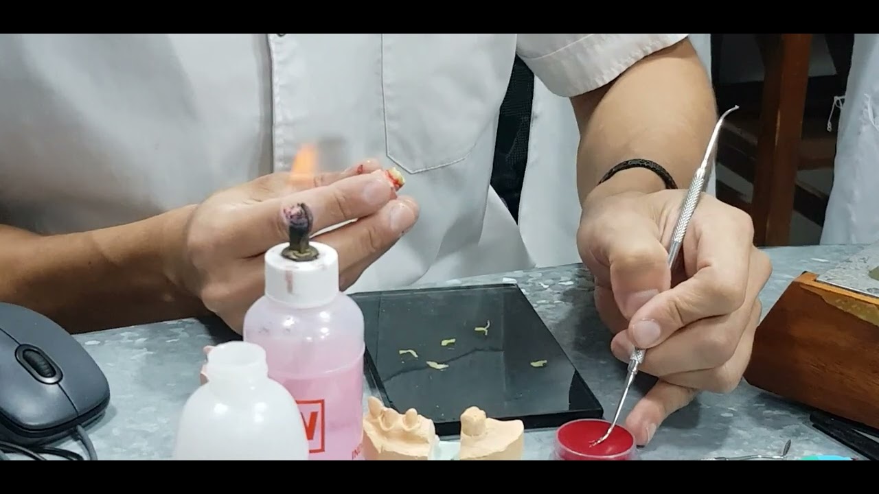 Técnica de elaboración de un patrón de cera - Protesis Dental ...