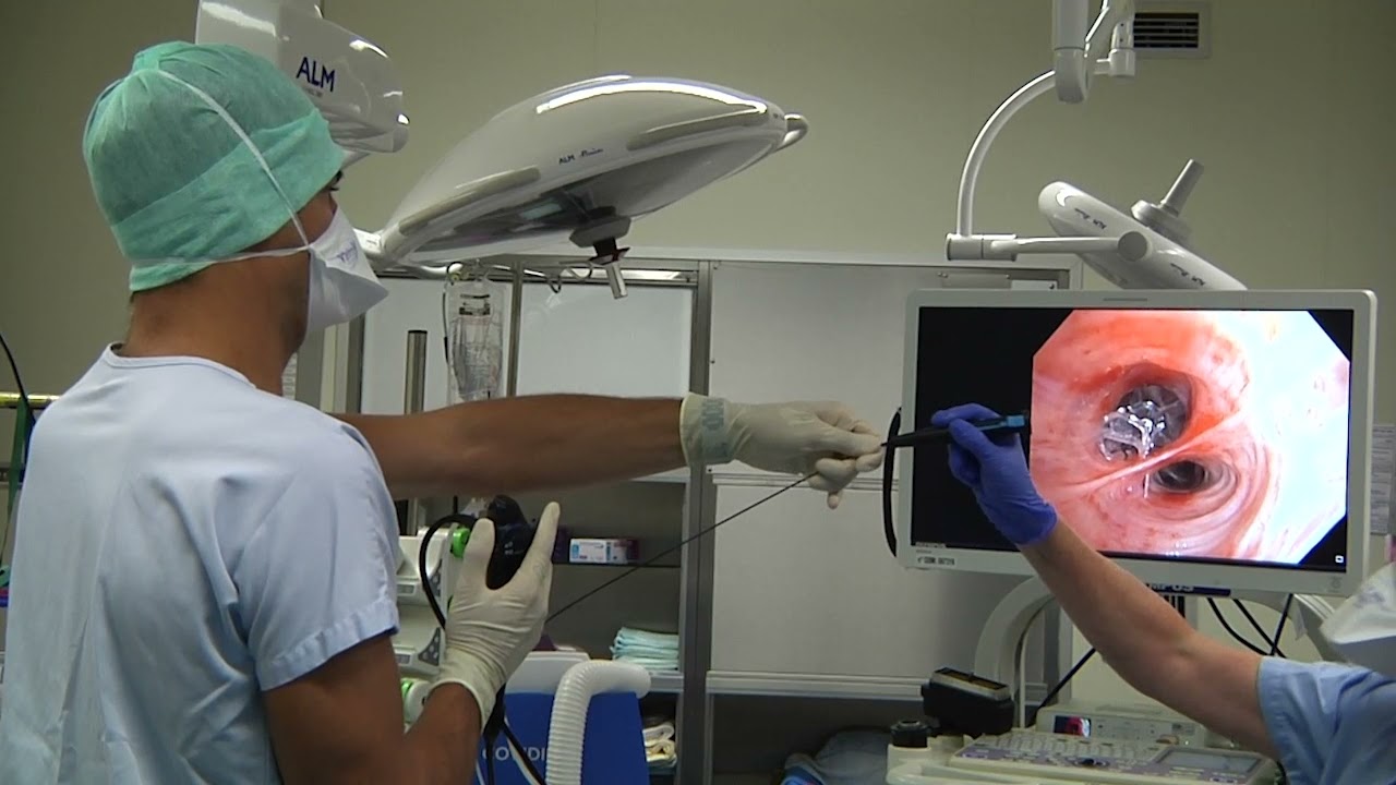 Emphysème pulmonaire : un traitement endobronchique innovant au CHU de ...