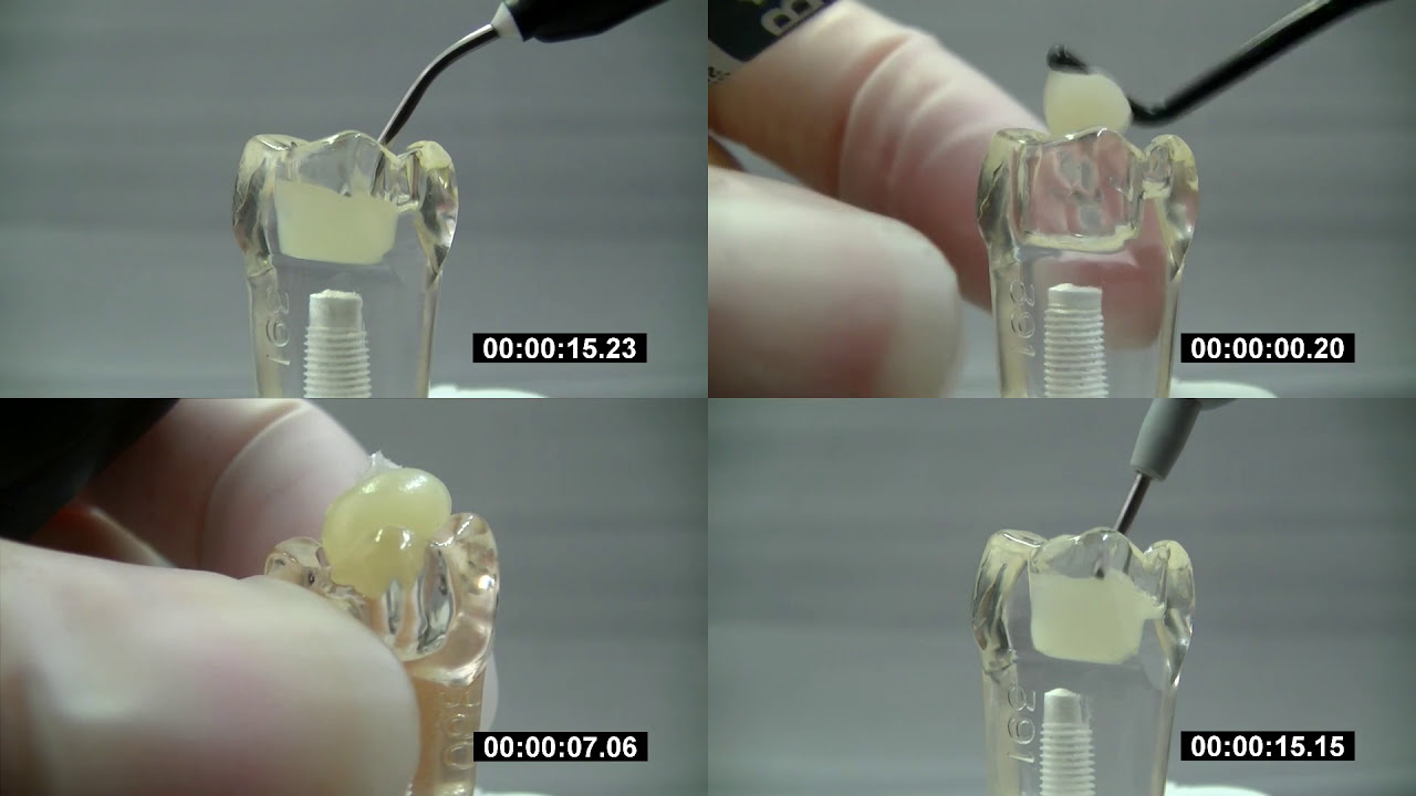 ESTELITE BULK FILL FLOW im Vergleich | Tokuyama Dental - YouTube