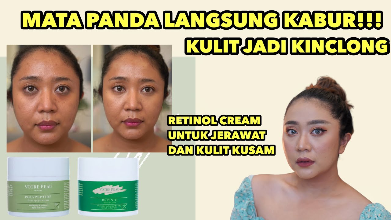 CARA MENGHILANGKAN MATA PANDA (REVIEW VOTRE PEAU POLYPEPTIDE FRESH EYE ...