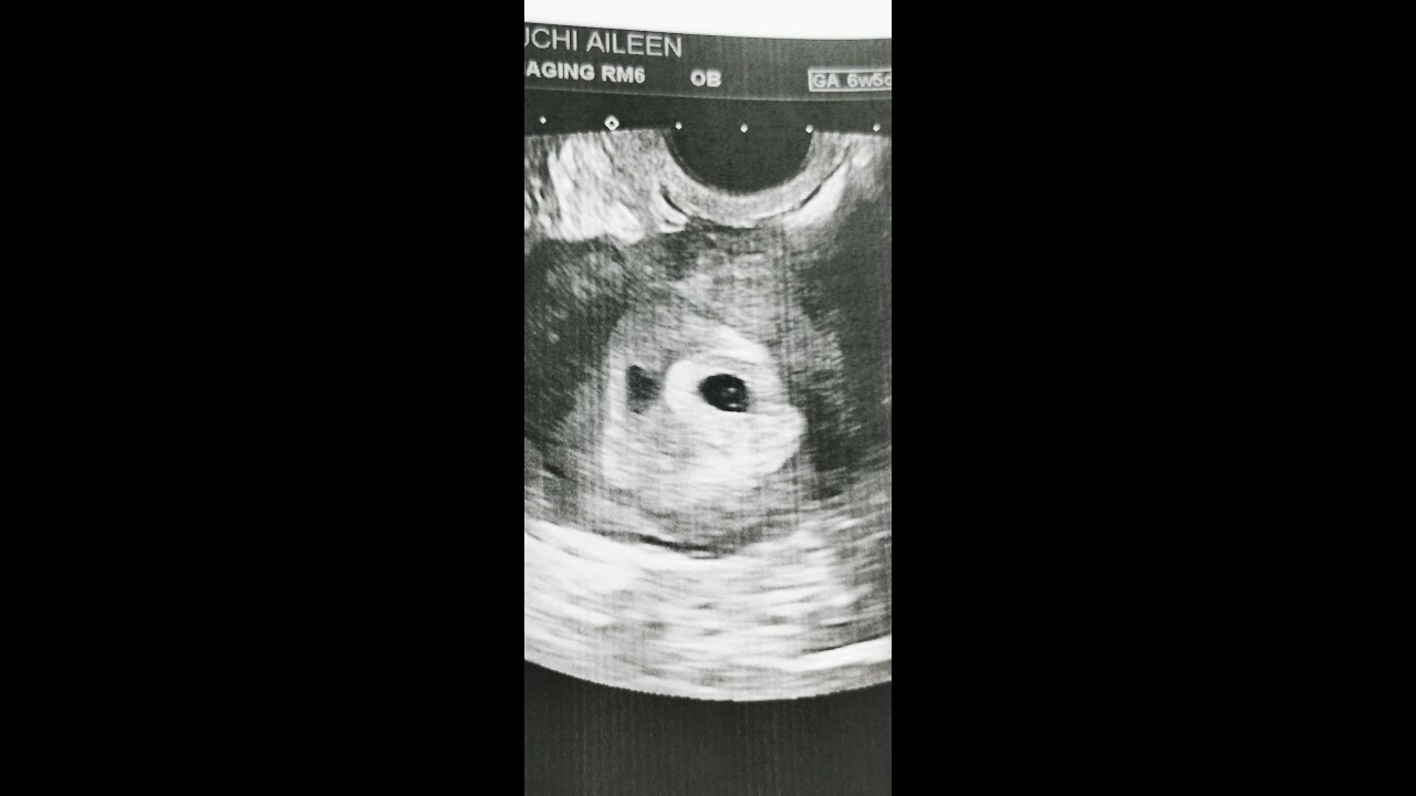 Dating ultrasound ( 5 weeks 5 days) - YouTube