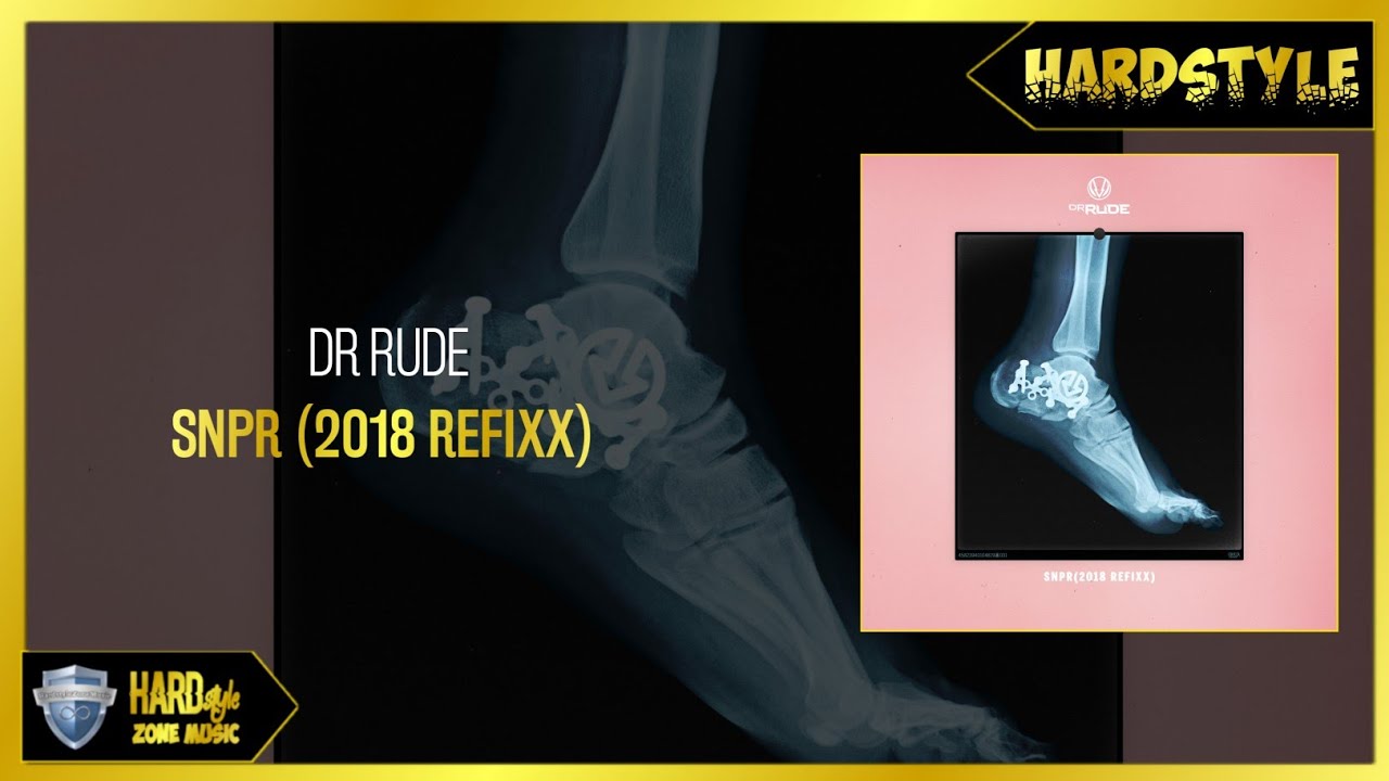 Dr Rude - SNPR (2018 Refixx) (Extended) - YouTube