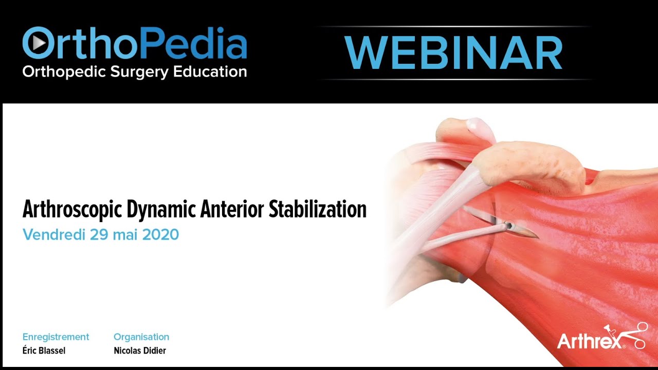 WEBINAR ARTHREX FRANCE - Arthroscopic Dynamic Anterior Stabilization ...
