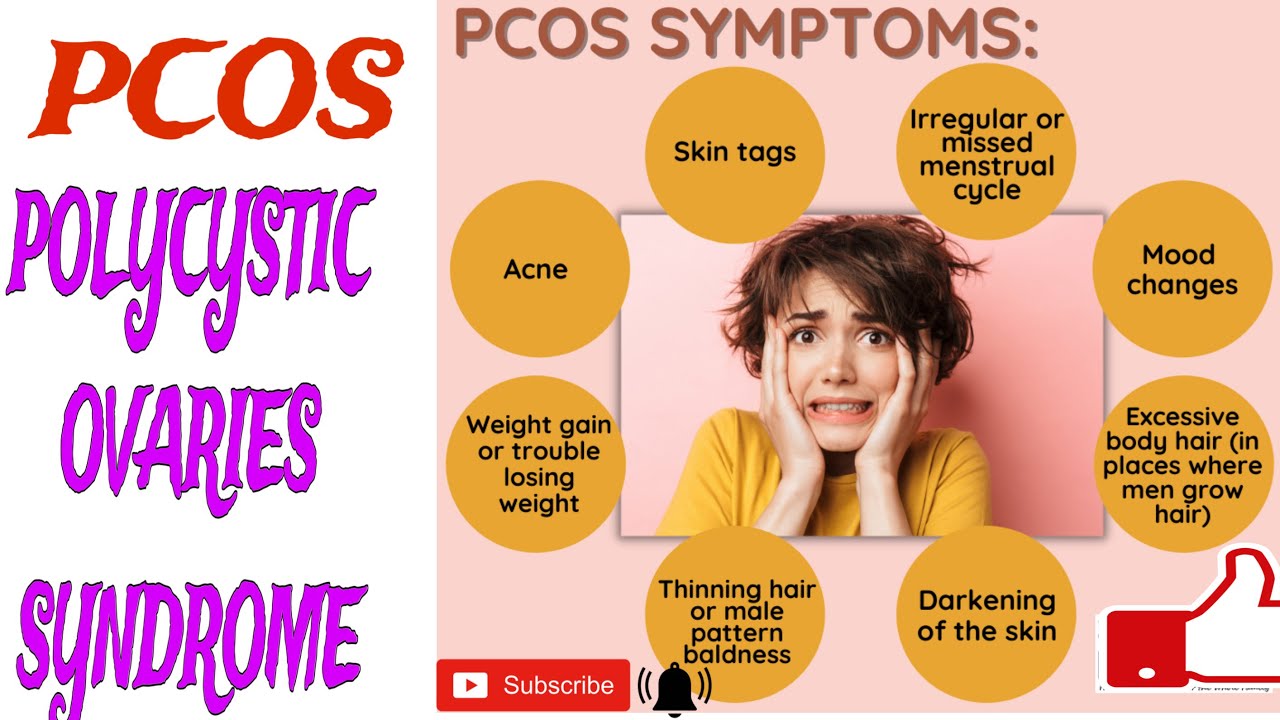 What is PCOS In Women?(Polycystic Ovary Syndrome).Is It Dangerous To ...