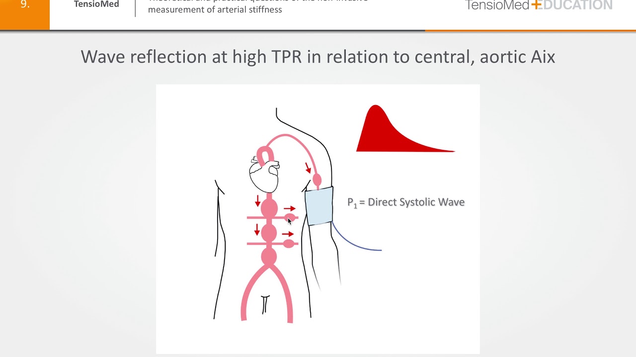 TensioMed Education Part 5 - The Arteriograph - YouTube