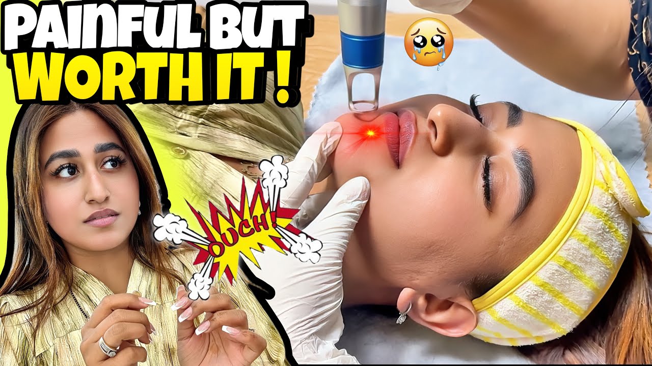 MY SKIN TRANSFORMATION BEGINS HERE! 🌟 #alizehjamali - YouTube